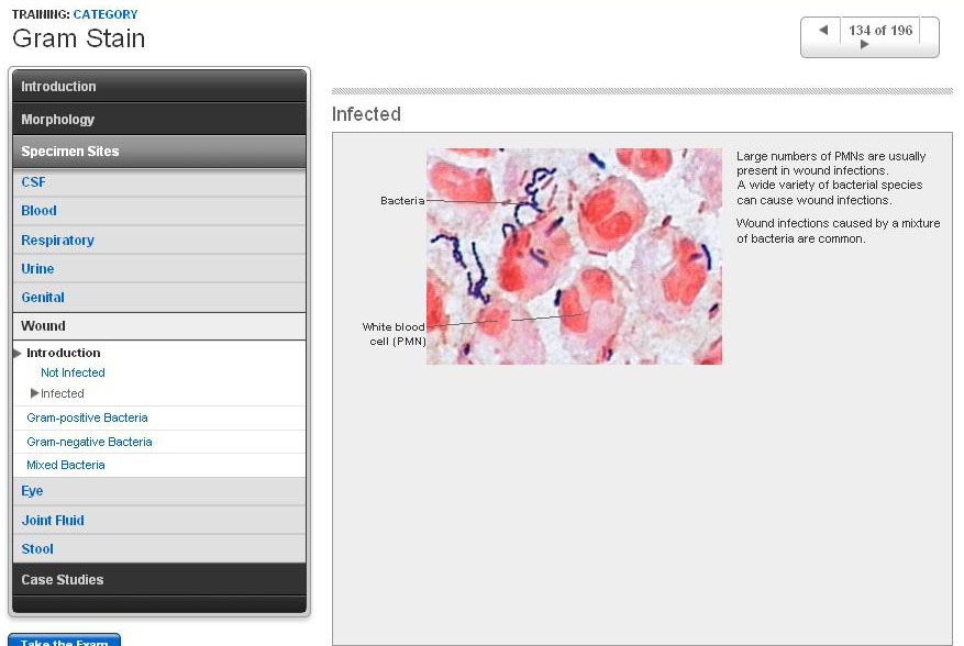 Gram Stain Tutor Sample Screens